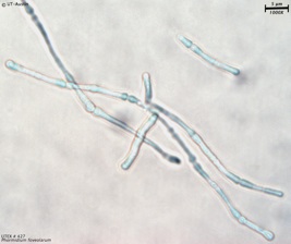 Things in the Springs